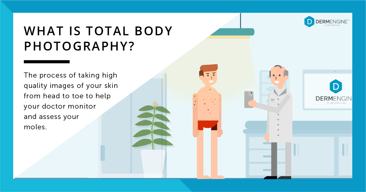 Total Body Photography - Fremantle Skin Cancer Clinic